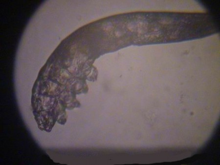 Haarbalgmilben - Demodex Folliculorum & Demodex Brevis - demodex.de