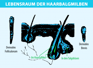 Haarbalgmilben - Demodex Folliculorum & Demodex Brevis - demodex.de